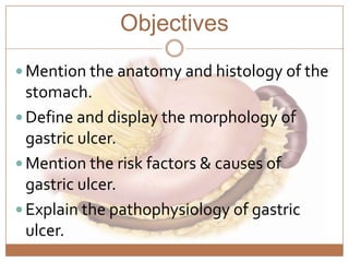 Gastric Ulcer | PPTX