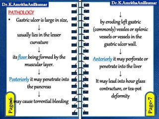 Gastric ulcer by Dr.K.AmrithaAnilkumar | PPTX