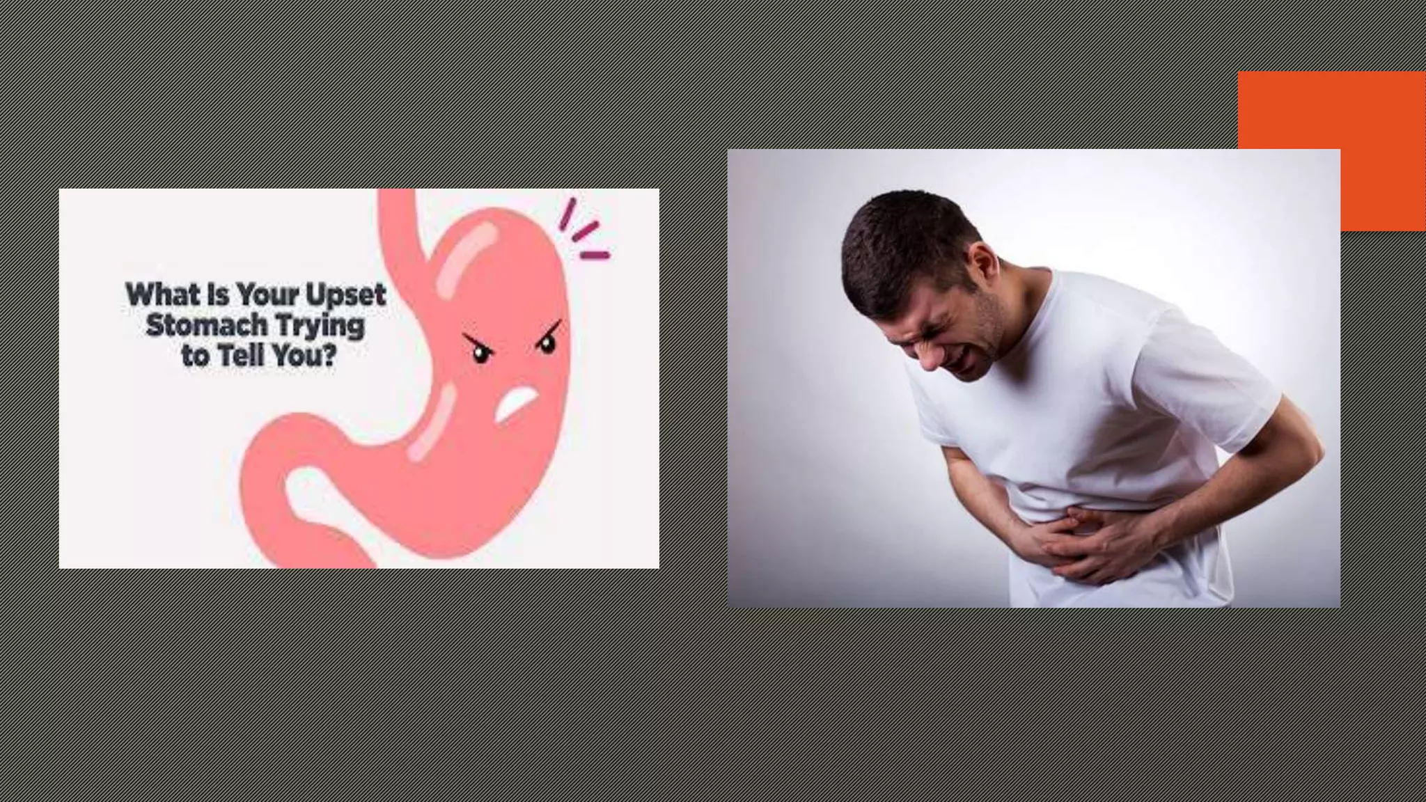 Gross and Histopathological findings & complications of GASTRIC ULCERS ...