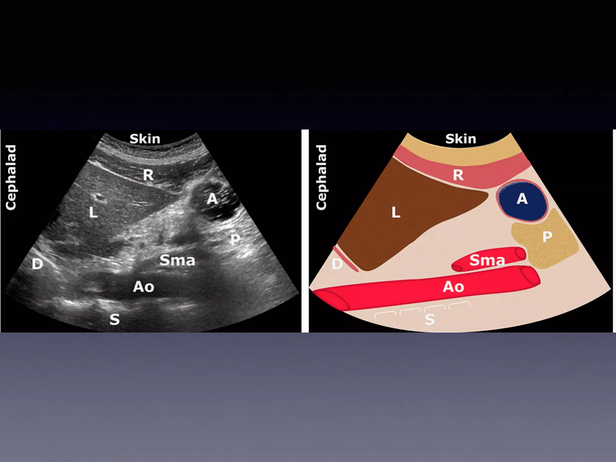 Gastric Ultrasound Tutorial 2019 Ppt