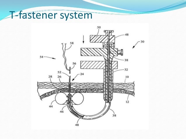 Gastric volvulus and other types of volvulus