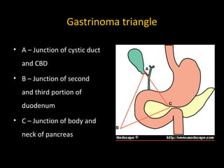 Gastrinoma Triangle