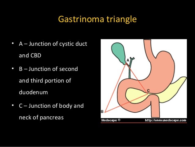 Gastrinoma. Zollinger-Ellison syndrome