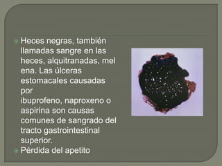 Gastritis | PPTX