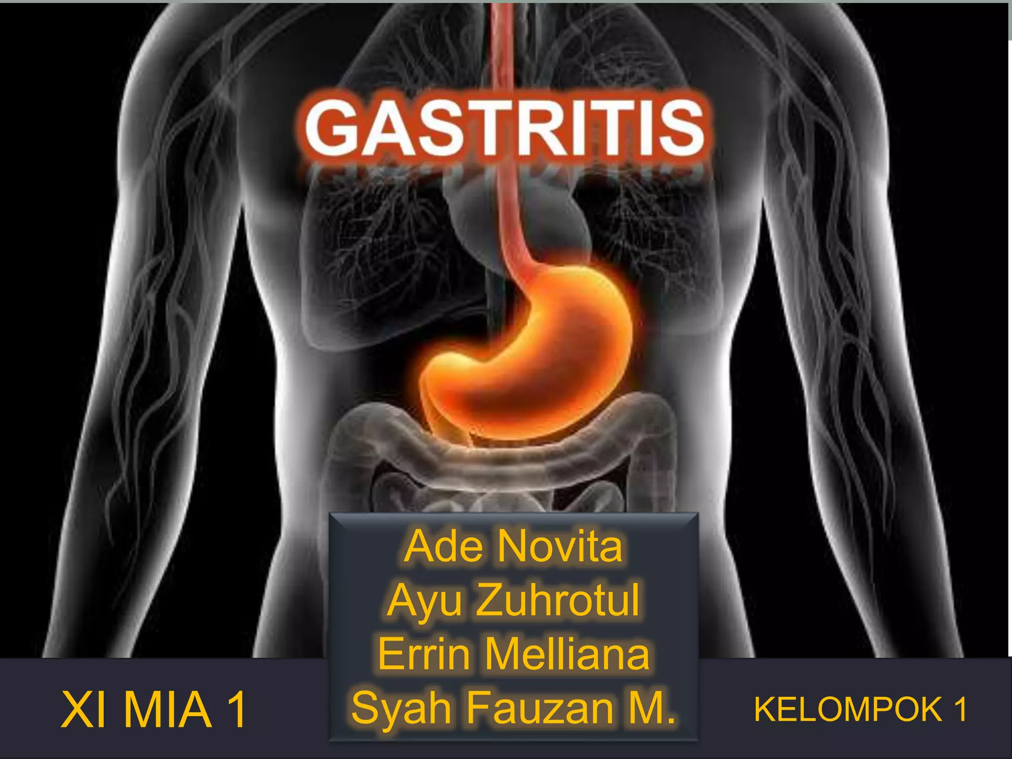 Gastritis | PPTX