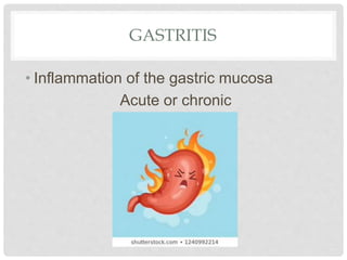 Gastritis | PPTX