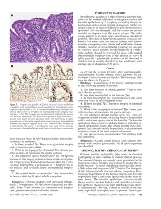 Gastritis.pdf | Digestive Disorders | Diseases and Conditions