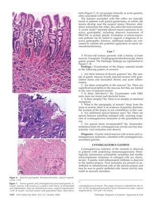 Gastritis.pdf | Digestive Disorders | Diseases and Conditions