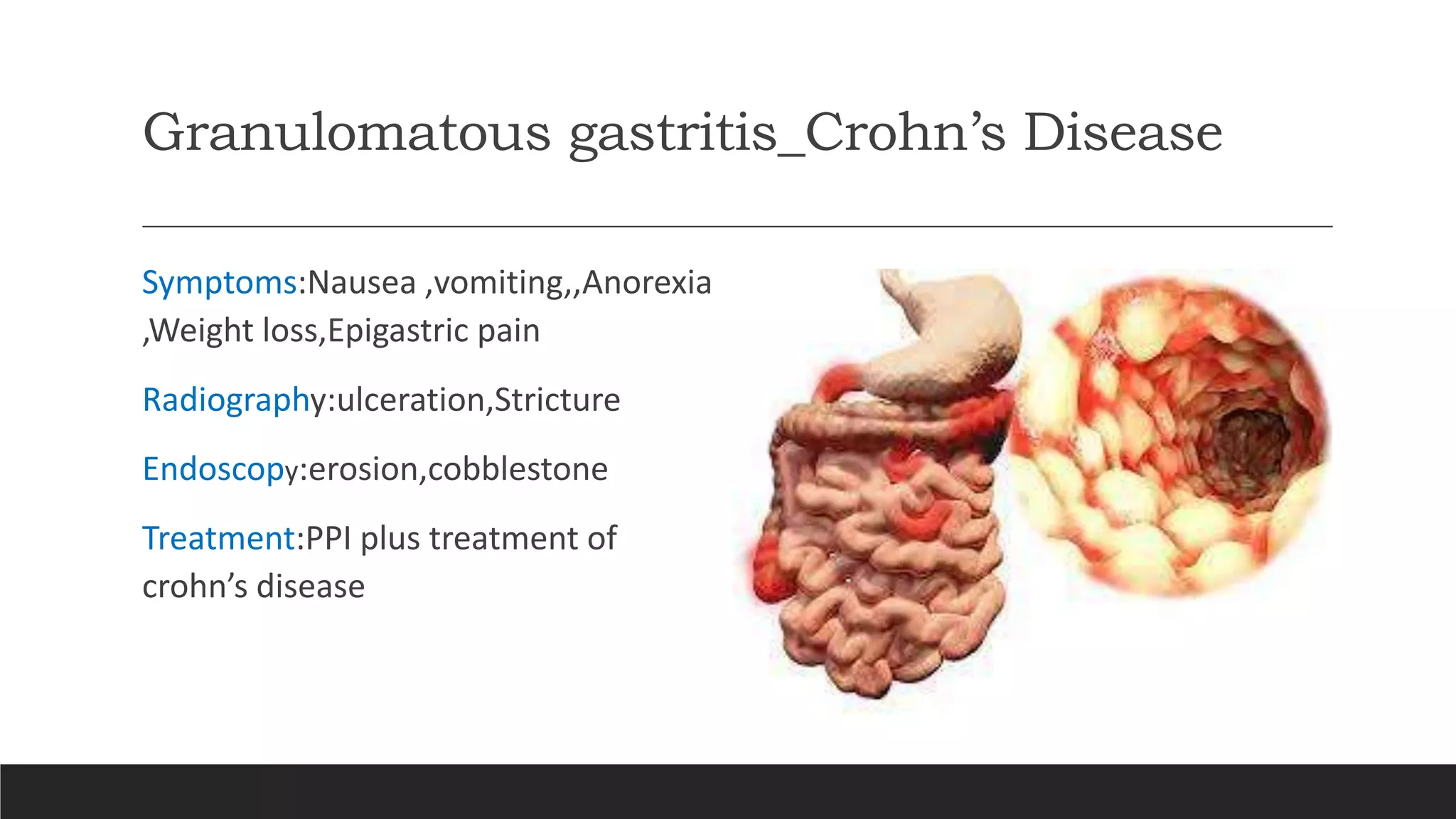 Gastritis.pptx