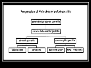 GASTRITIS.ppt