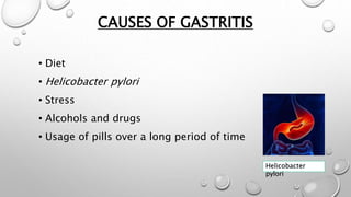 Gastritis.pptx