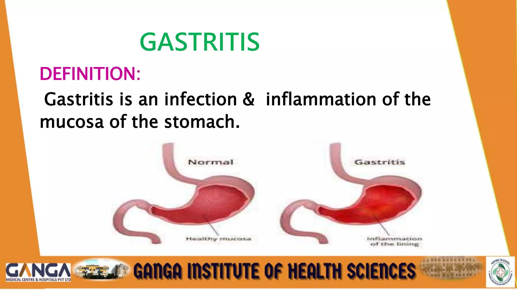 GASTRITIS.pptx | Digestive Disorders | Diseases and Conditions