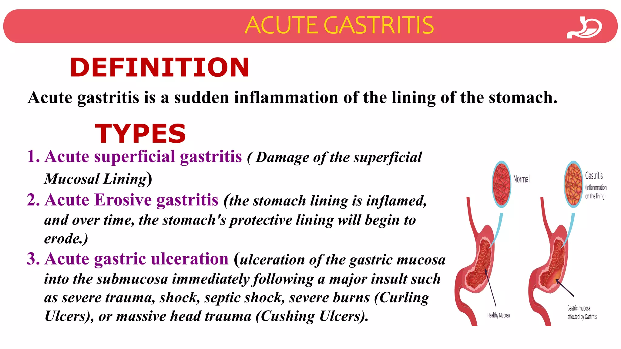 GASTRITIS.pptx