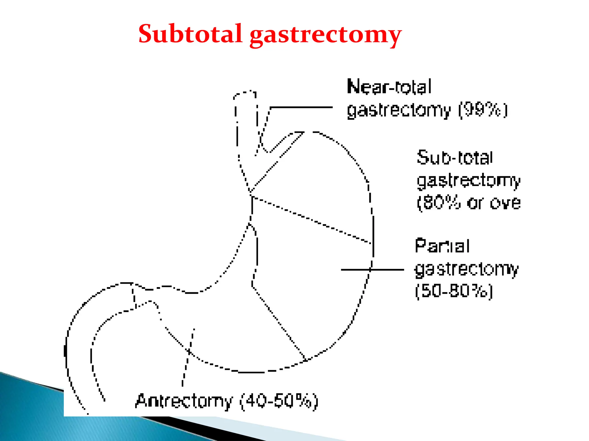 Gastritis.pptx Gastro Intestinal Disorder | PPTX
