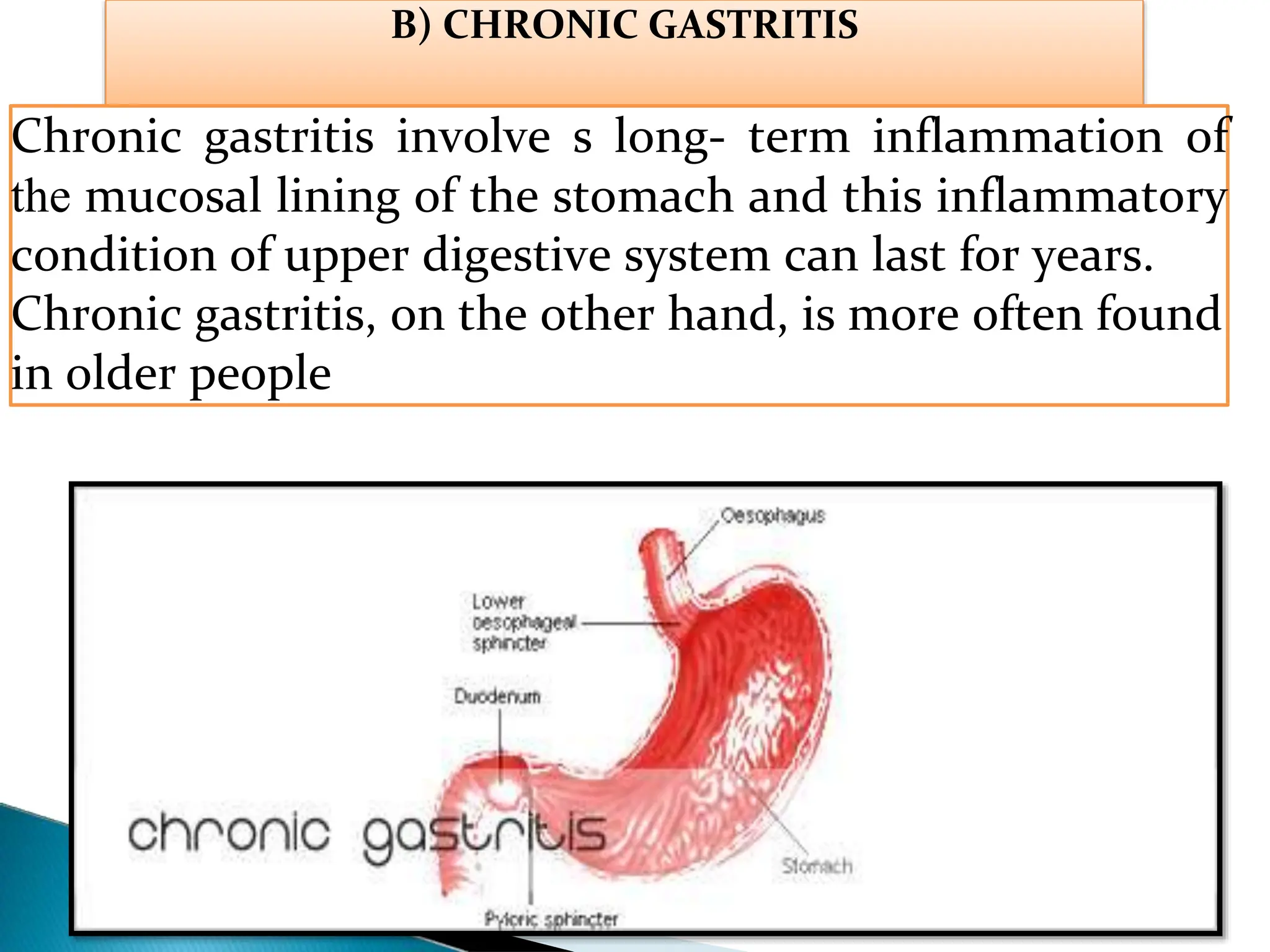 Gastritis.pptx Gastro Intestinal Disorder | PPTX