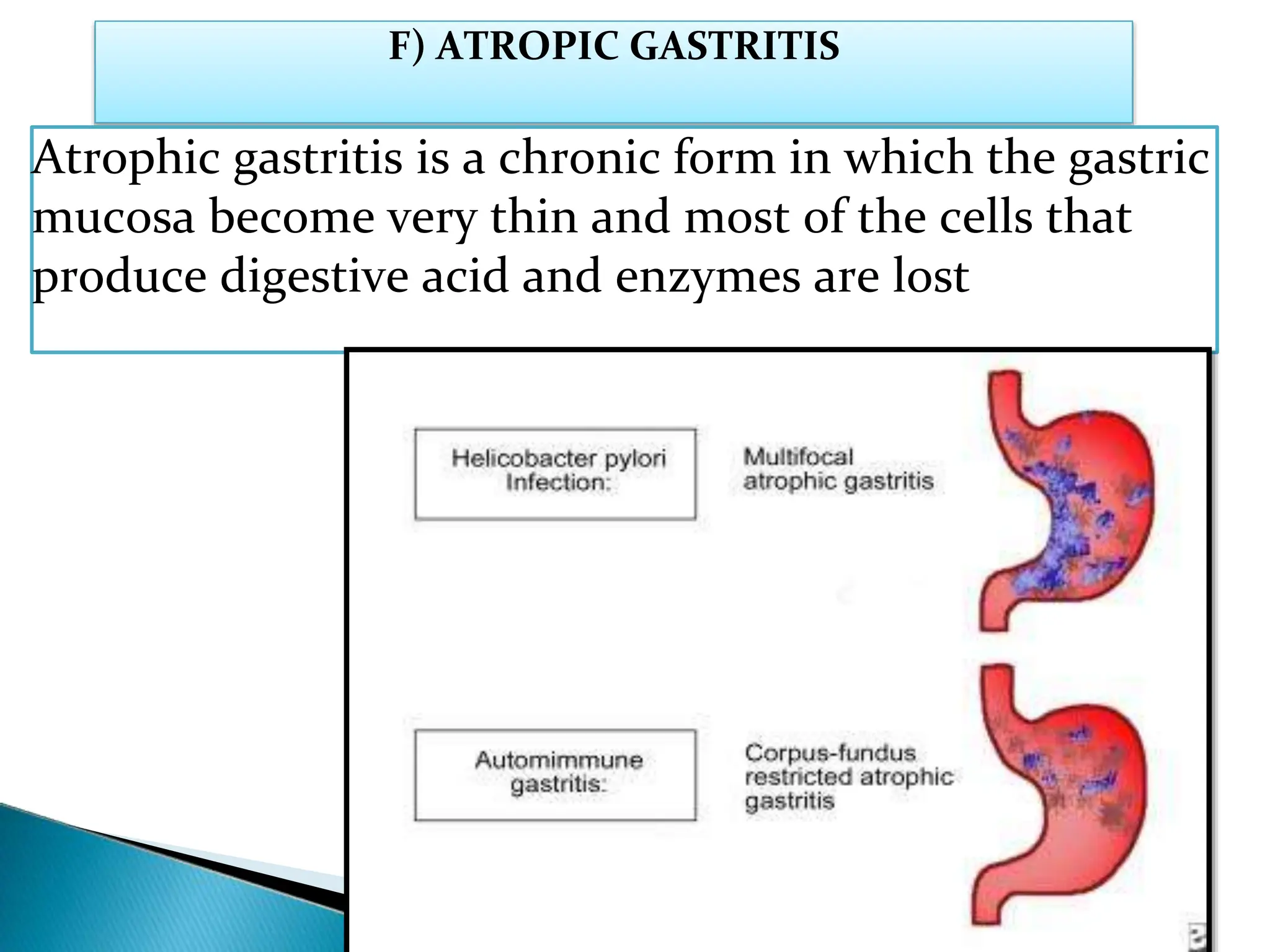 Gastritis.pptx Gastro Intestinal Disorder | PPTX