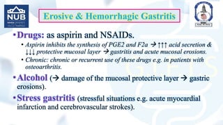 Gastritis including H. pylori for undergraduate | PPTX