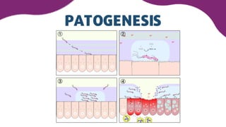 GASTRITIS TINJAUAN PUSTAKA GASTRTIS.pptx