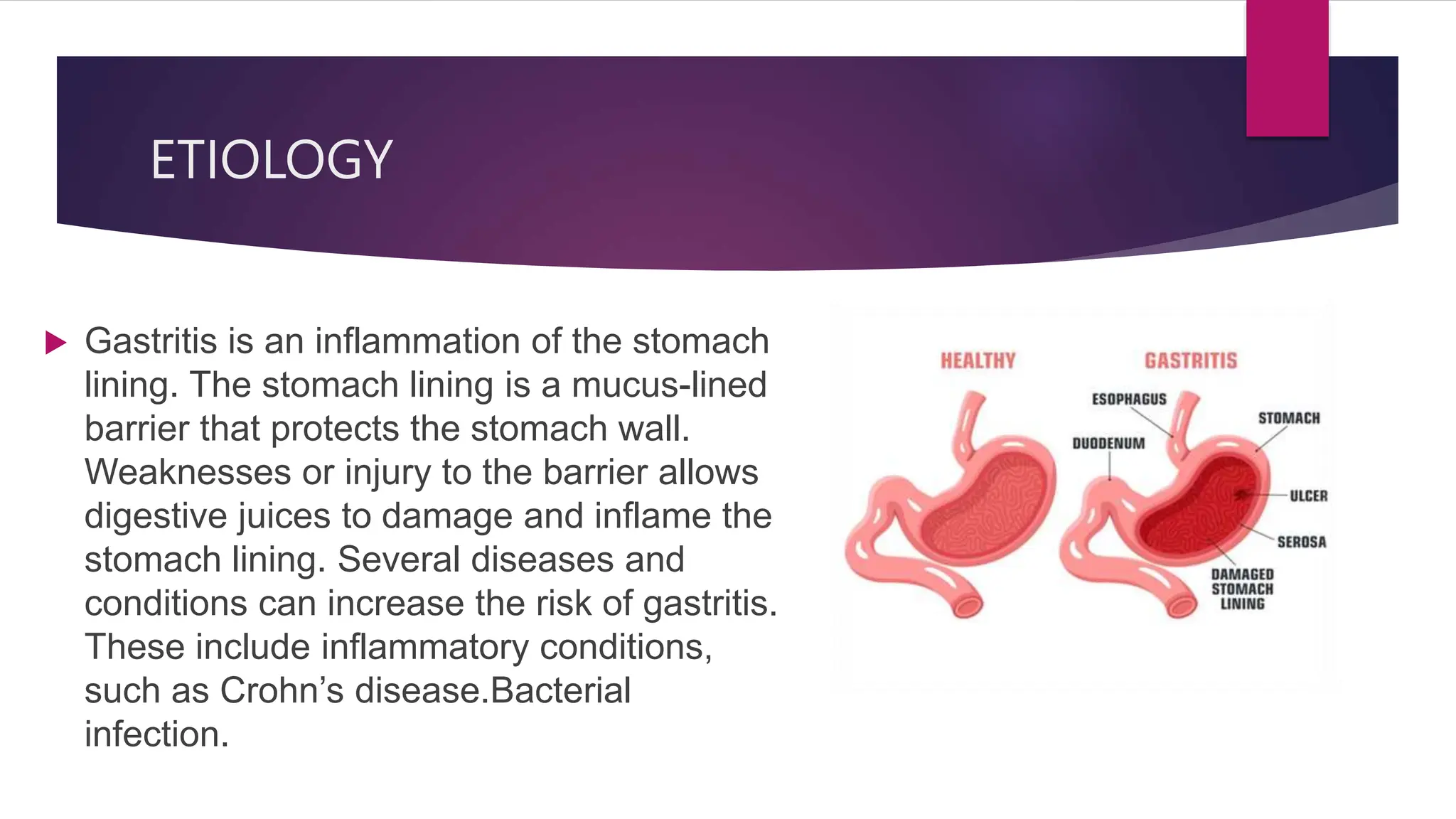 MORPHOLOHY,ETIOLOGY AND TREATMENT OF GASTRITIS .pptx