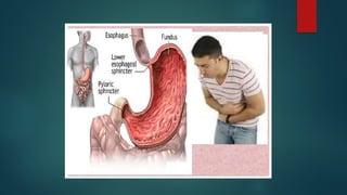 penyakit gastritis dan gejala,pencegahannya | PPTX