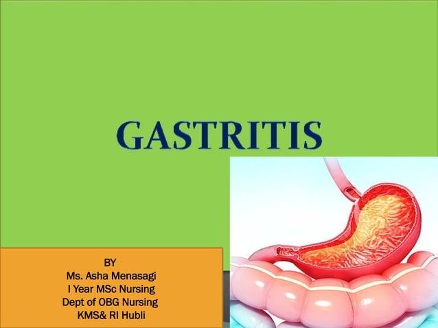 The GASTRITIS & Its Management.... pptx | PPTX