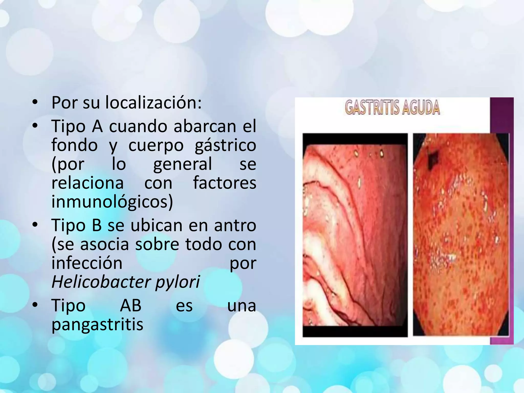Gastritis aguda-y-crónica | PPTX
