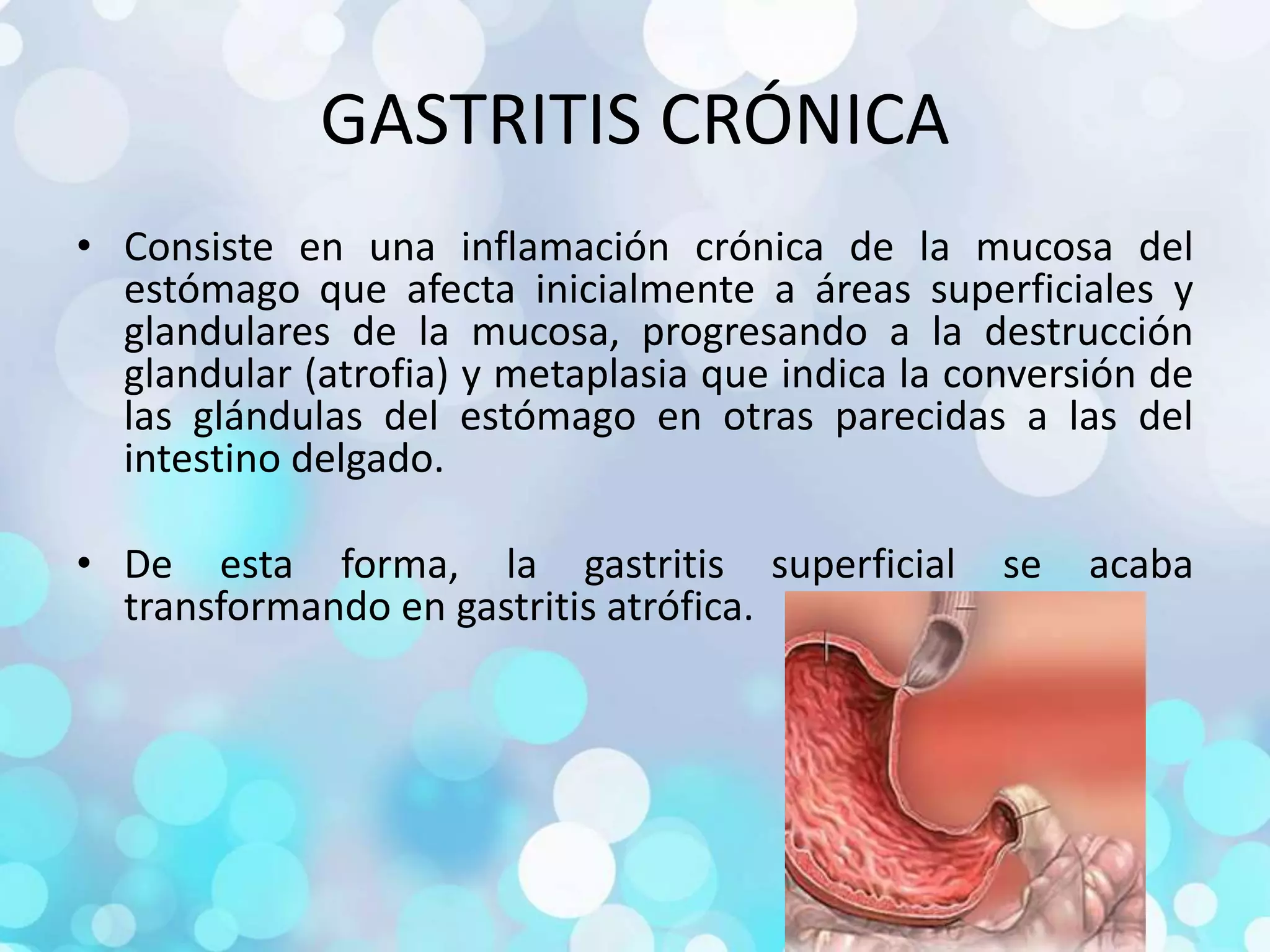 Gastritis aguda-y-crónica | PPTX