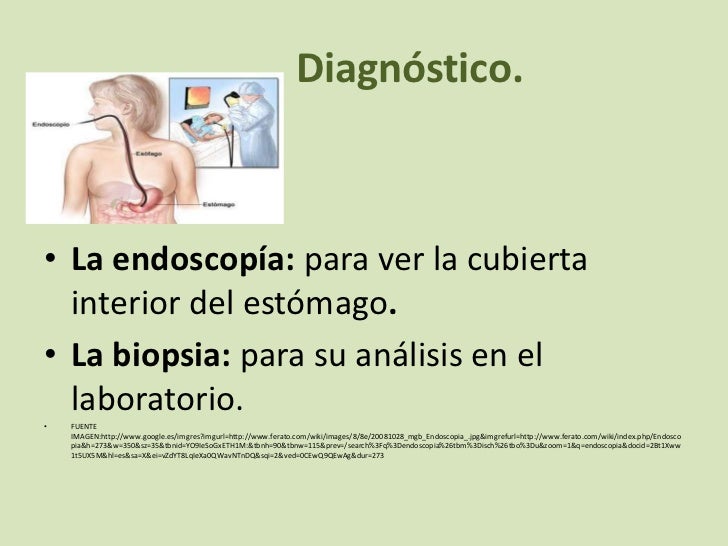 Endoscopia Para Gastritis Diet - dexposts