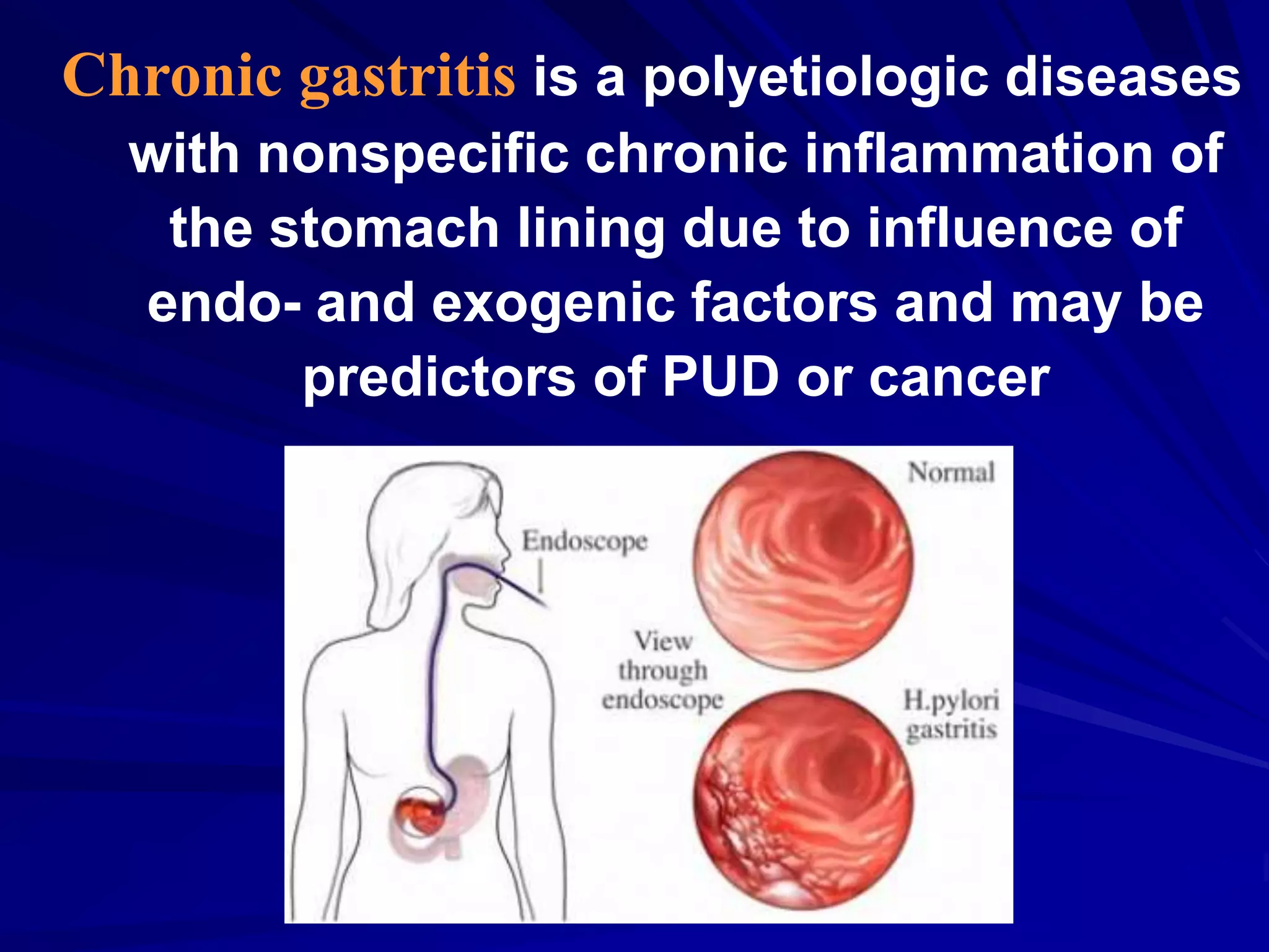 gastritis 16.ppt