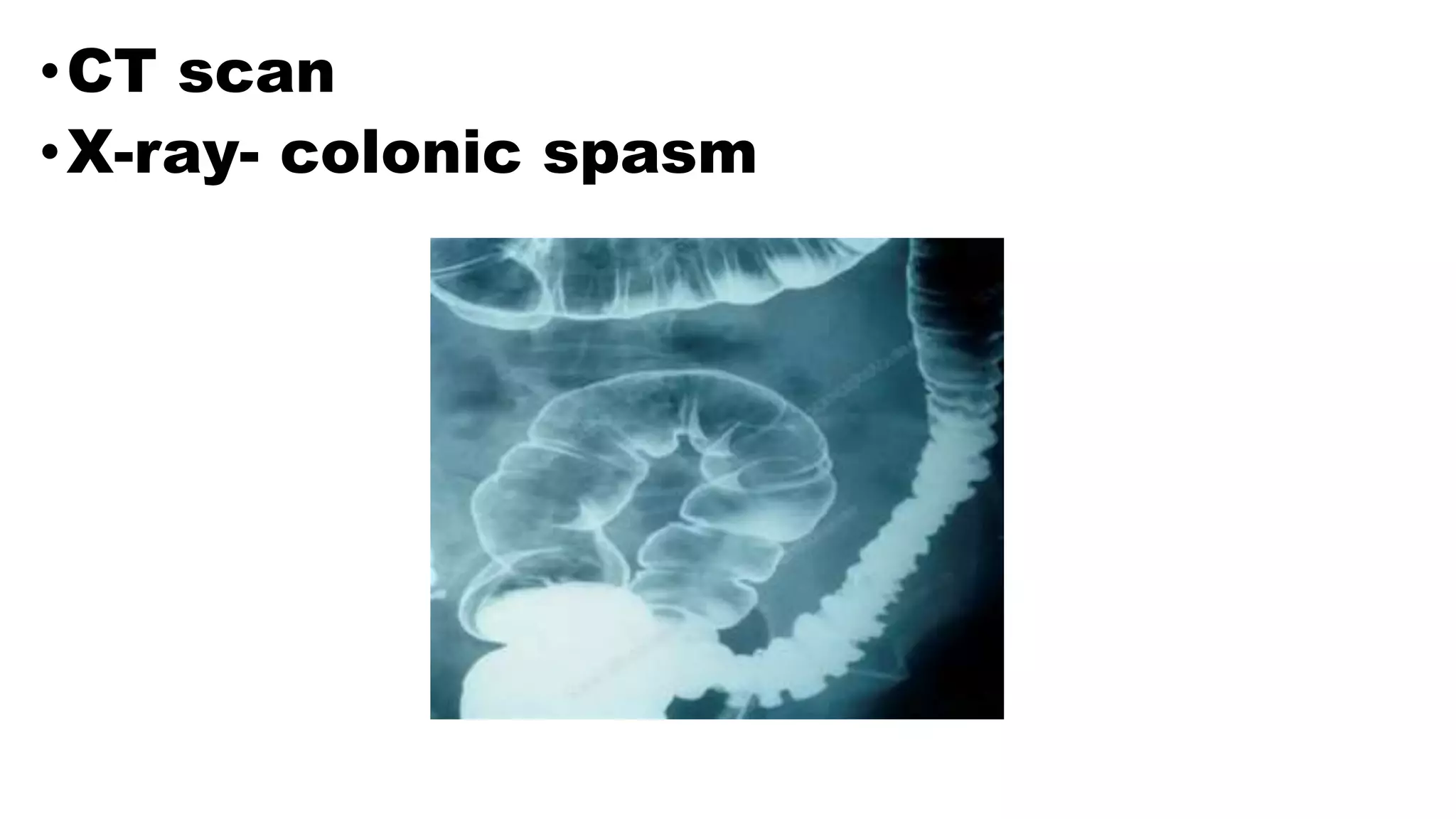 Gastritis and irritable bowel syndrome | PPTX