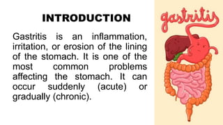 Gastritis and irritable bowel syndrome | PPTX