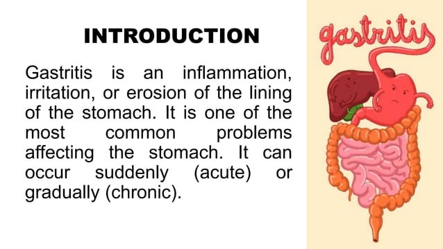 Gastritis and irritable bowel syndrome | PPTX | Digestive Disorders ...