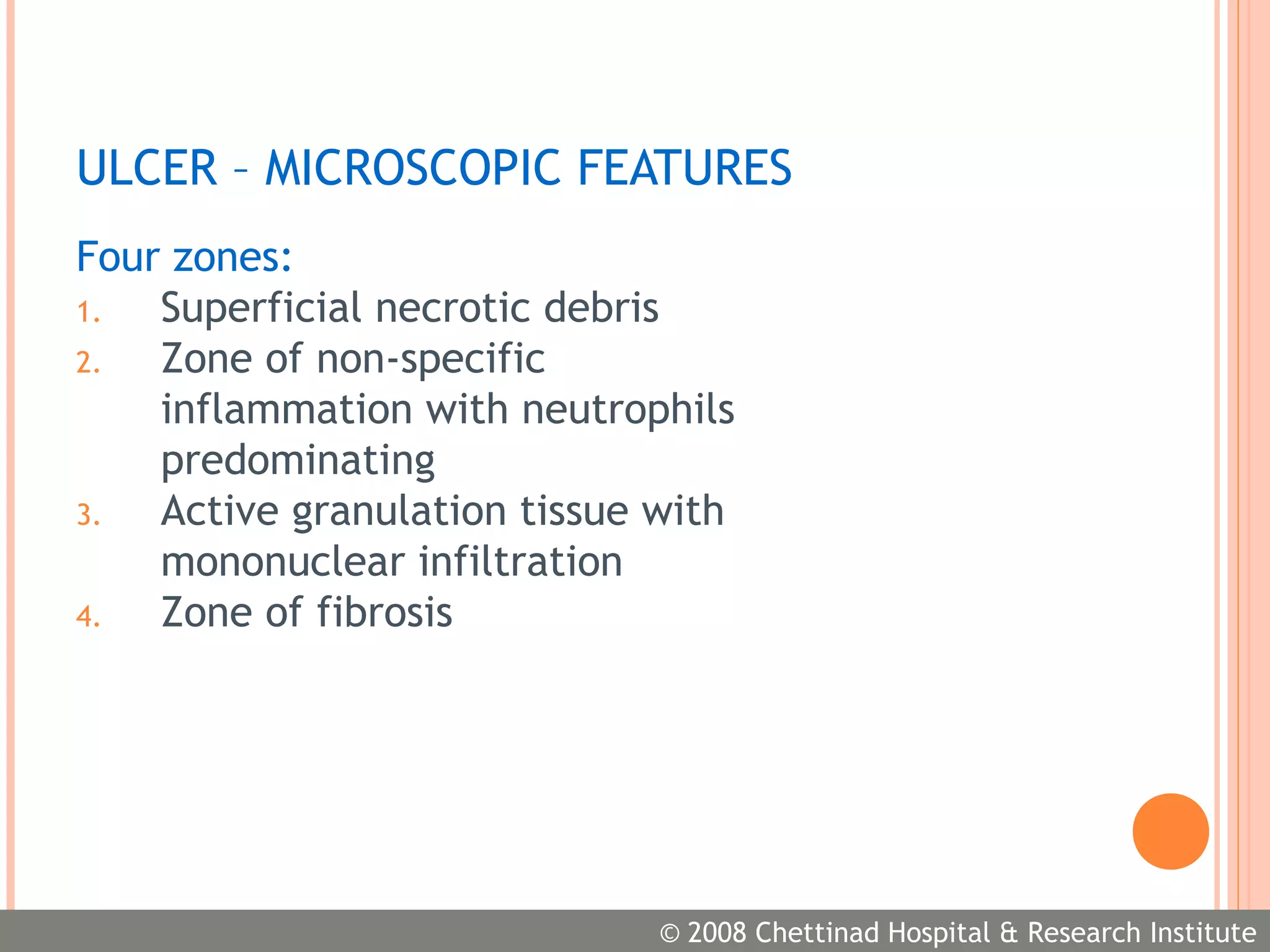 Gastritis and peptic ulcer 30 5-2016 | PPS