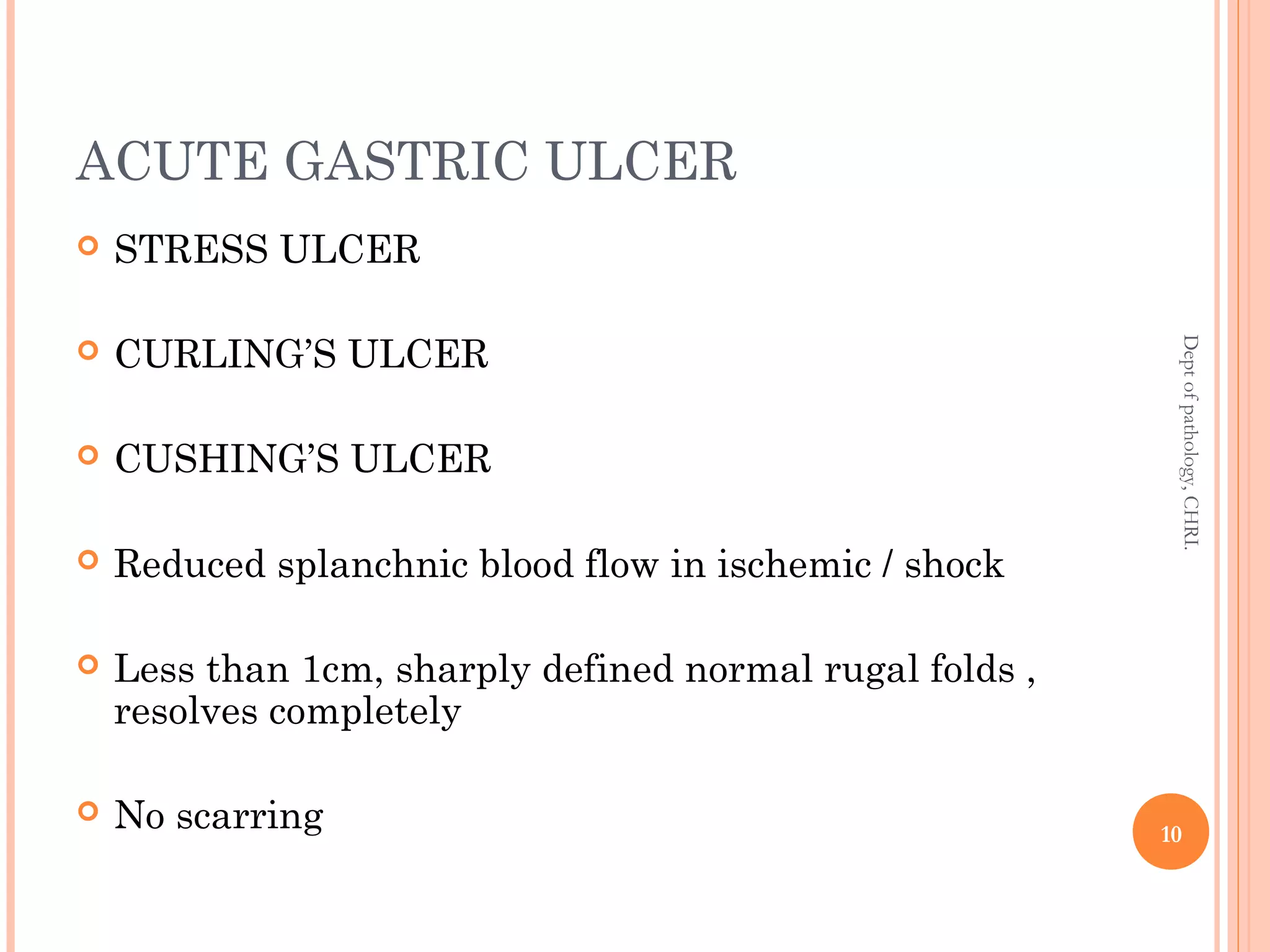 Gastritis and peptic ulcer 30 5-2016 | PPS