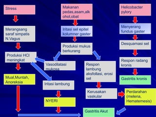 Gastritis pleno | PPT
