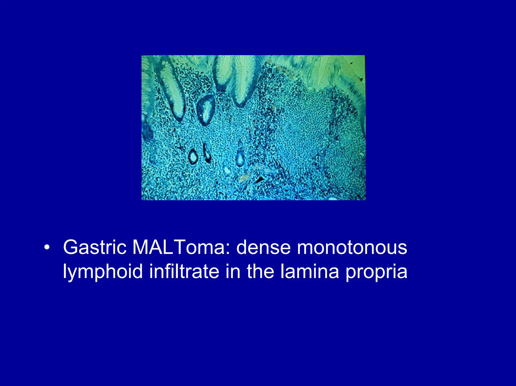 gastritis presentation.final.pdf
