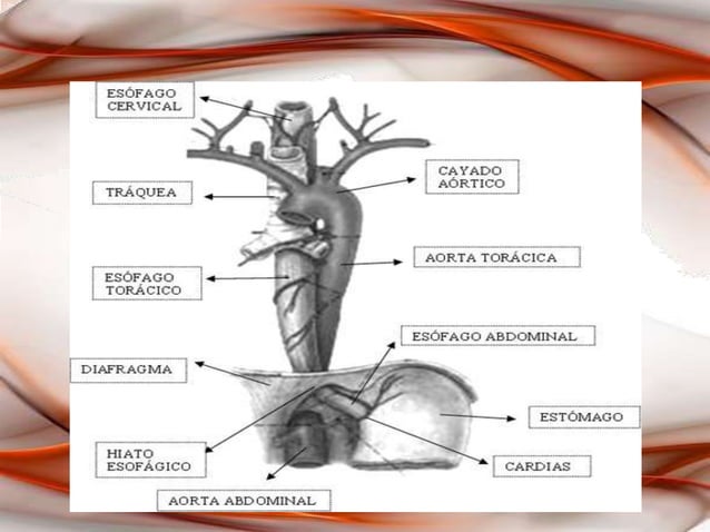 Gastro esofago | PPTX