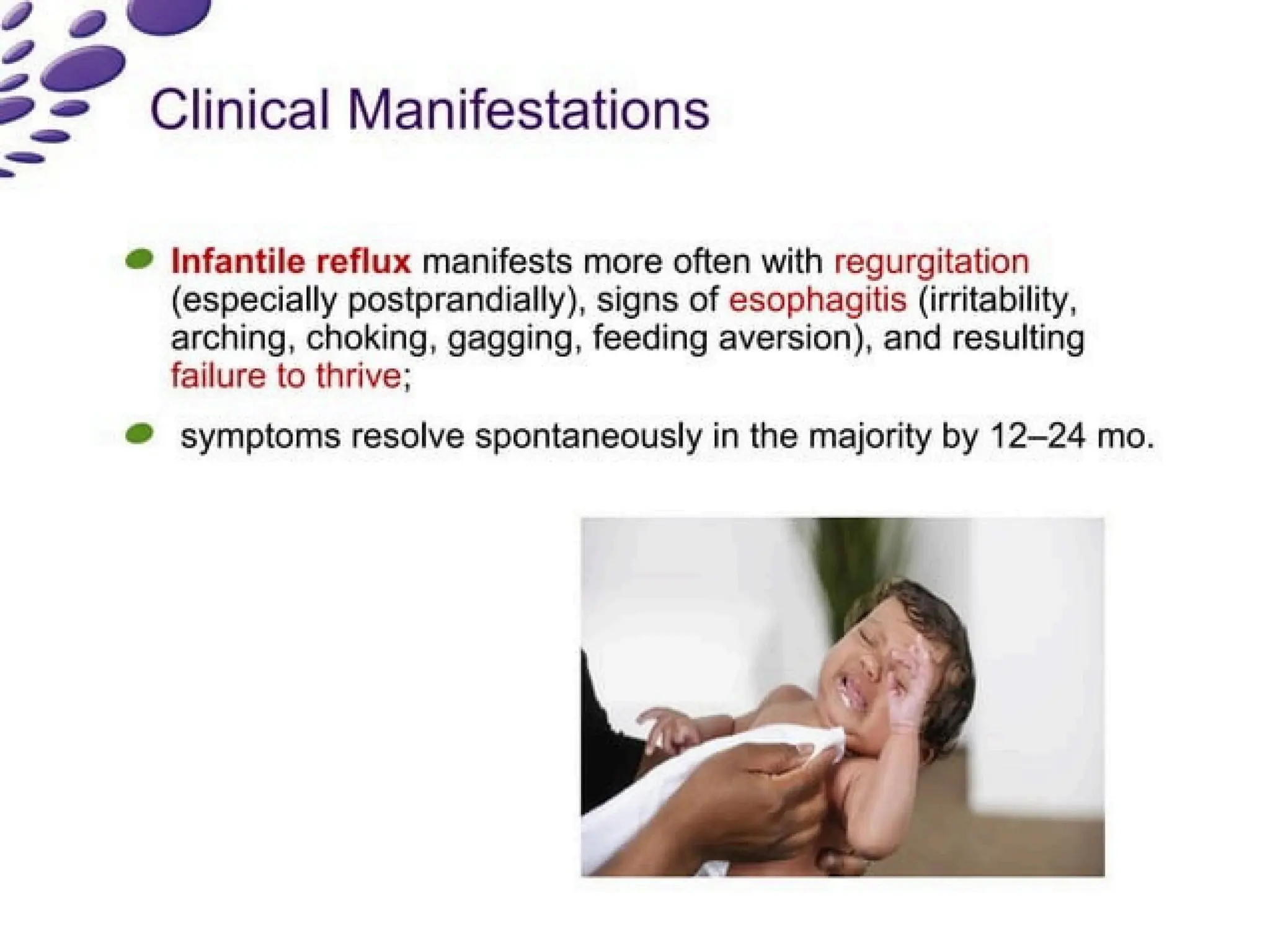 gastro-esophageal-reflux-disease-gerd-in-children (1)_OCR.pdf