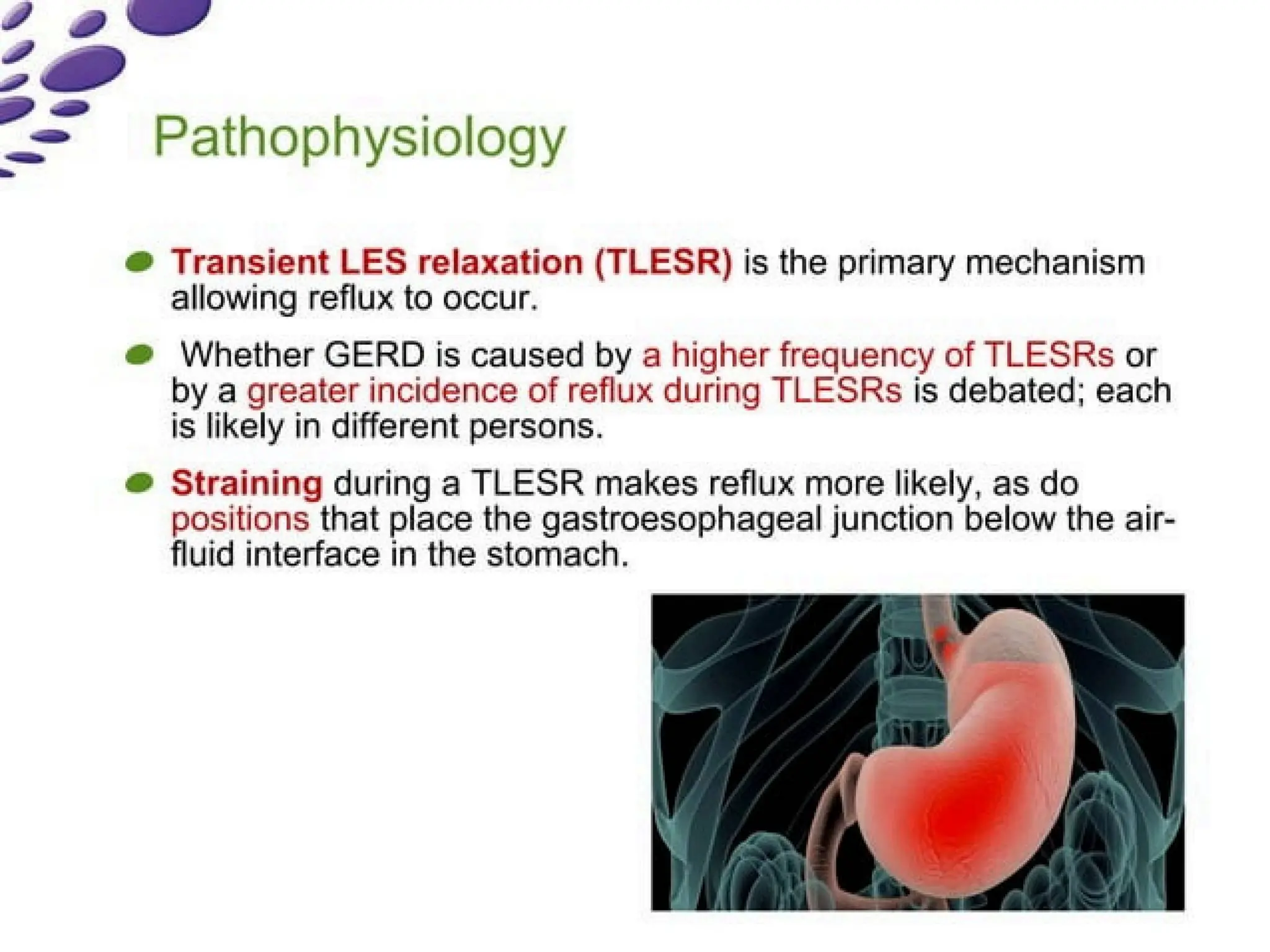 gastro-esophageal-reflux-disease-gerd-in-children (1)_OCR.pdf