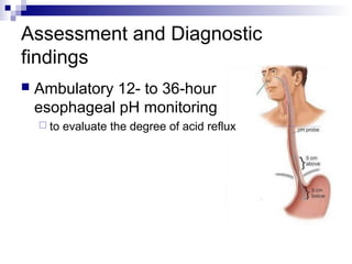 Gastro esophageal reflux disease (GERD) | PPT