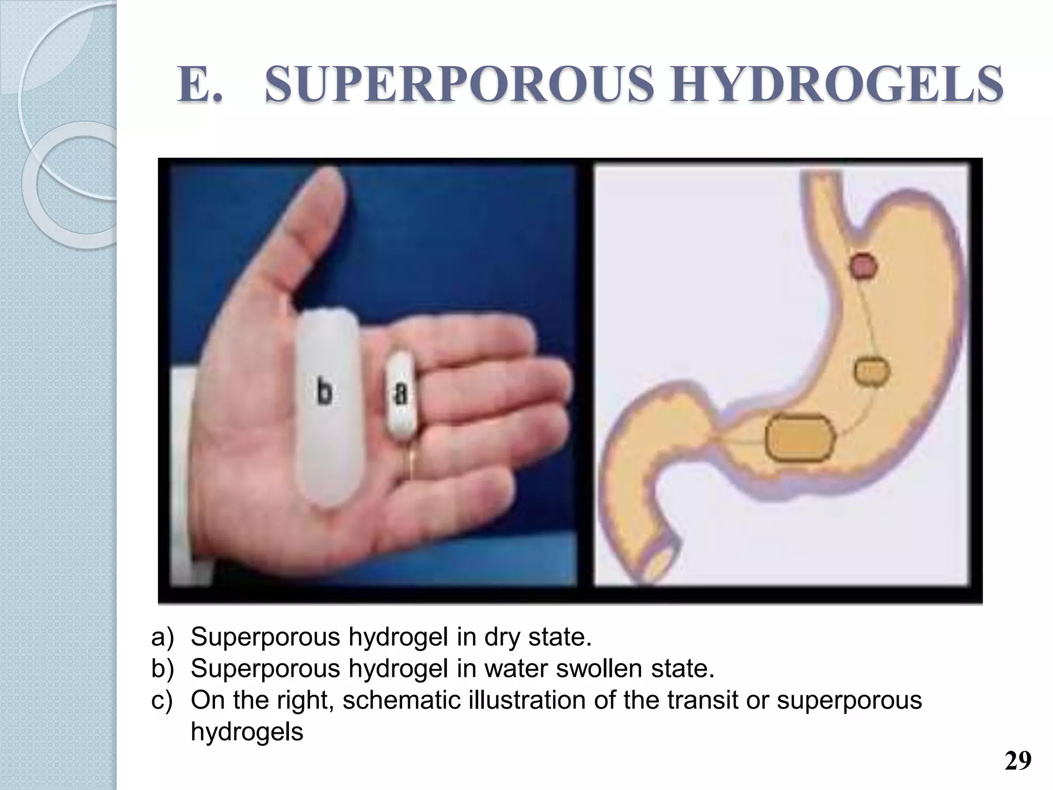 Gastro retentive drug delivery system (GRDDS) | PPTX