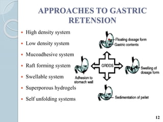 Gastro retentive drug delivery system (GRDDS) | PPTX