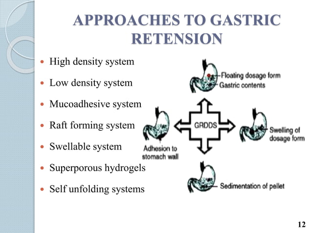 Gastro retentive drug delivery system (GRDDS) | PPTX | Digestive ...