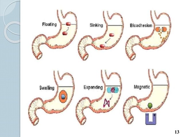 Gastro retentive drug delivery system (GRDDS) | PPTX | Digestive ...