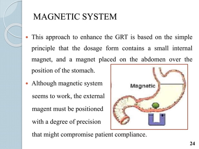 Gastro retentive drug delivery system (GRDDS) | PPTX | Digestive ...