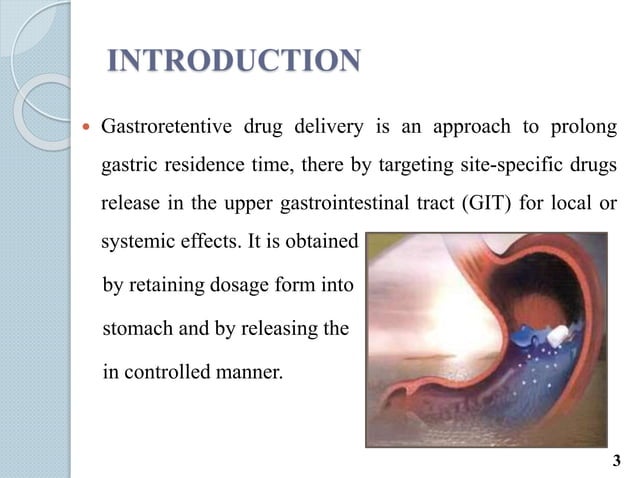 Gastro retentive drug delivery system (GRDDS) | PPTX | Digestive ...