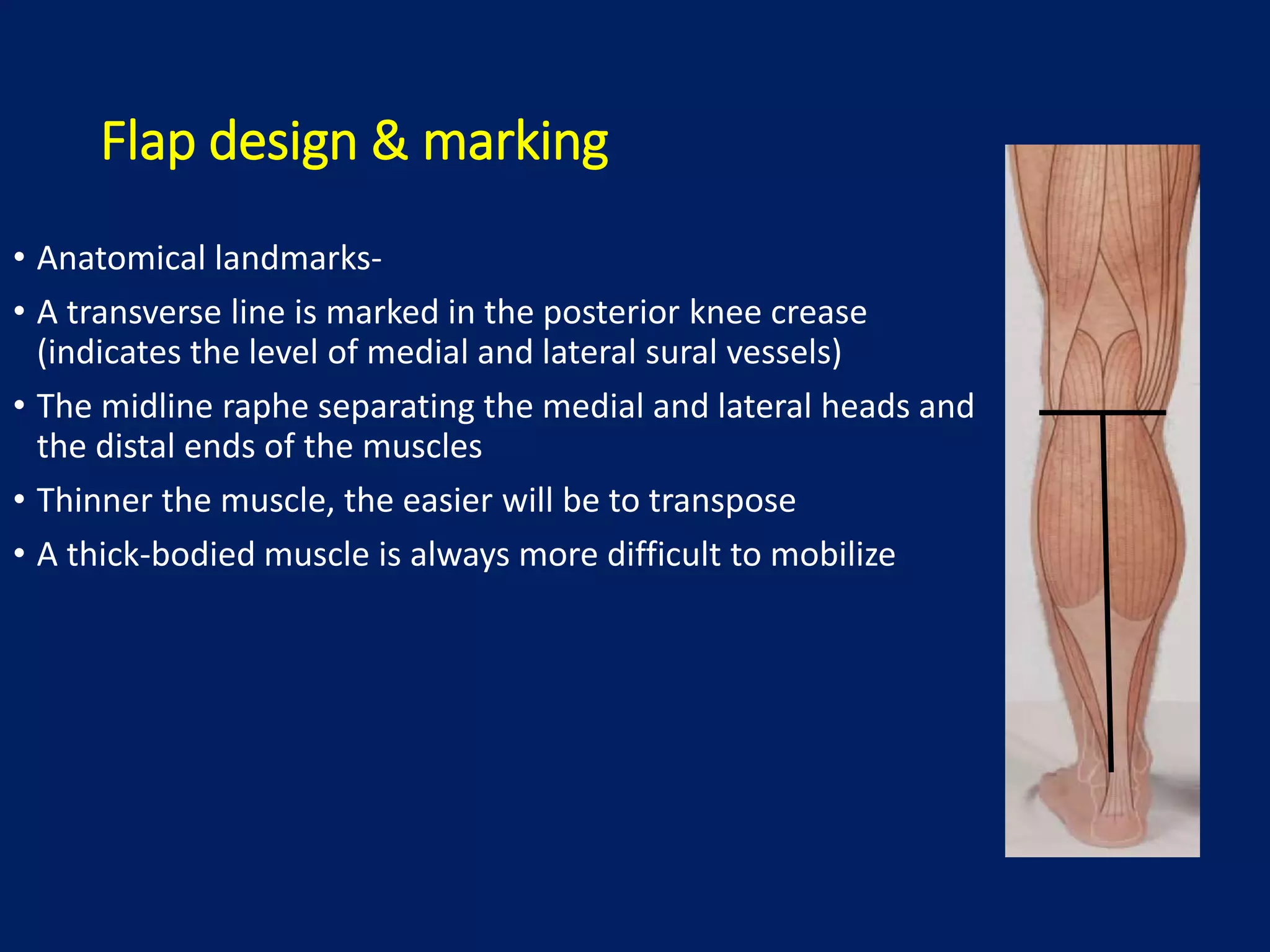 Gastrocnemius flap | PPTX