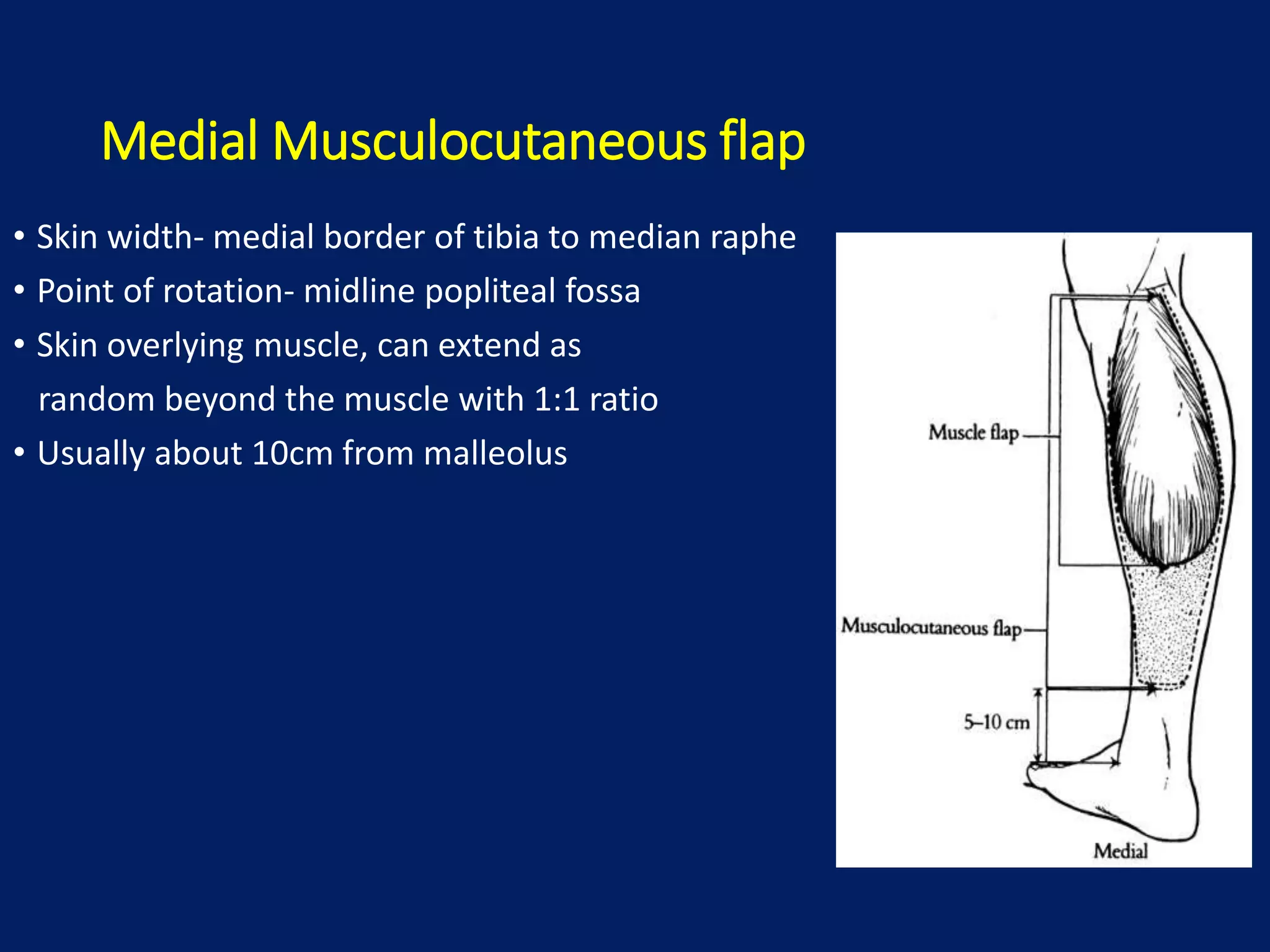 Gastrocnemius flap | PPTX