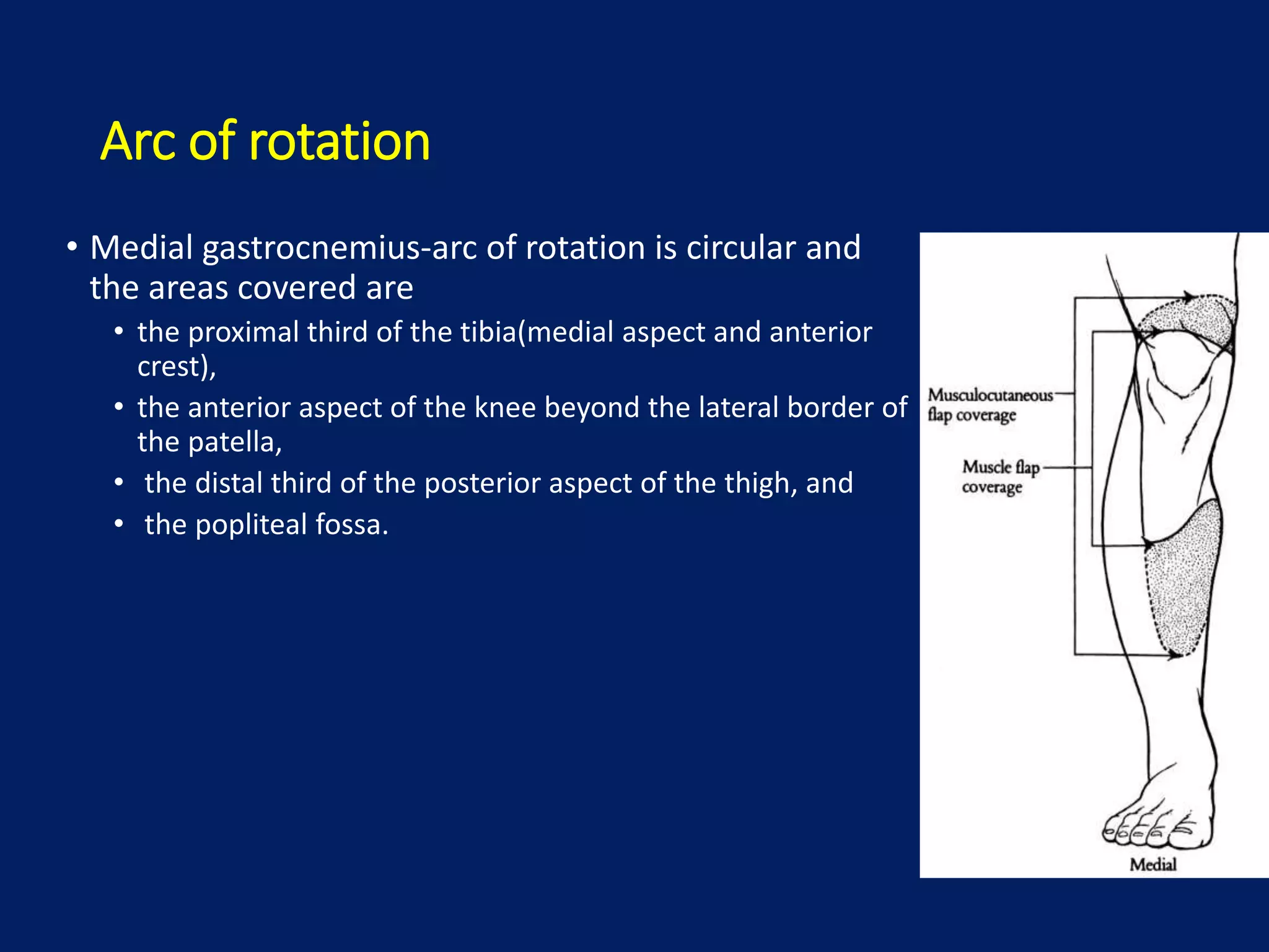 Gastrocnemius flap | PPTX