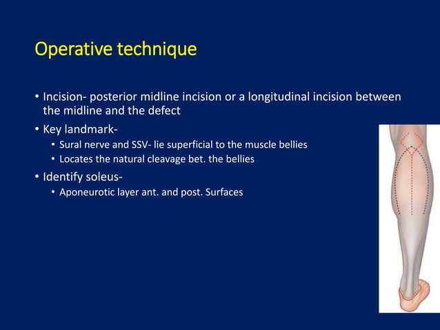 Gastrocnemius flap | PPTX | Death, Injury, or Military Conflict ...